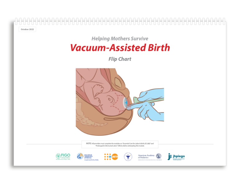 Flip Charts – Vacuum Assisted Birth – Prudent Meditech International